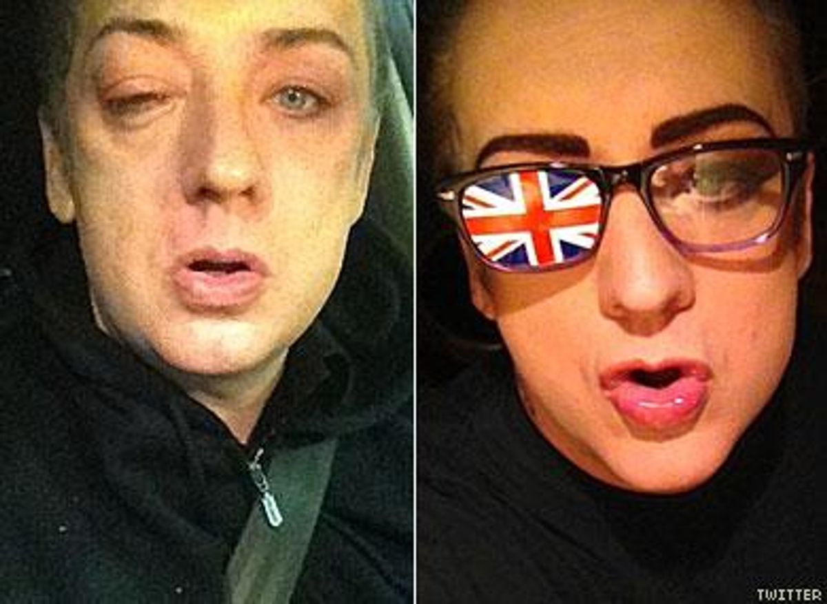 Boy George Assaulted Outside Club Tweets Photos