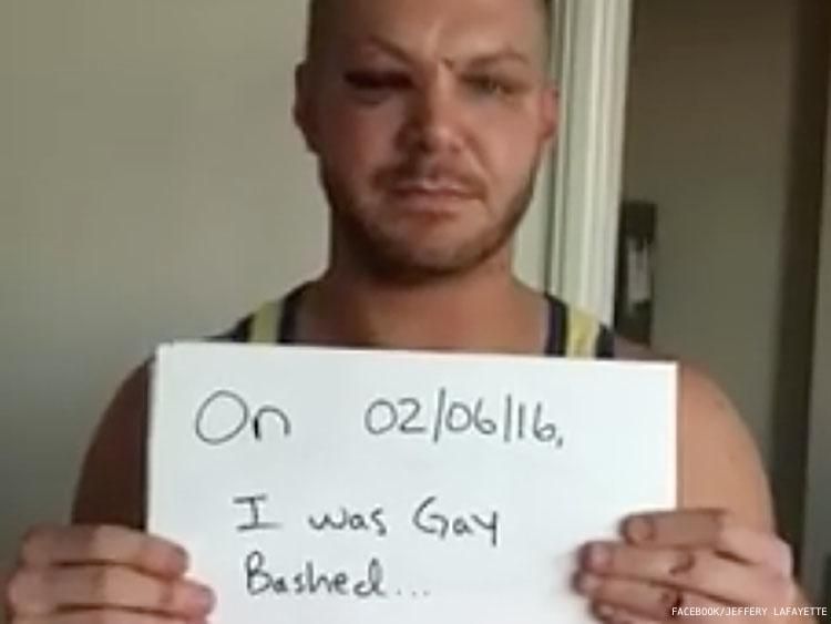 WATCH: Gay-Bashing Victim's Message of Hope