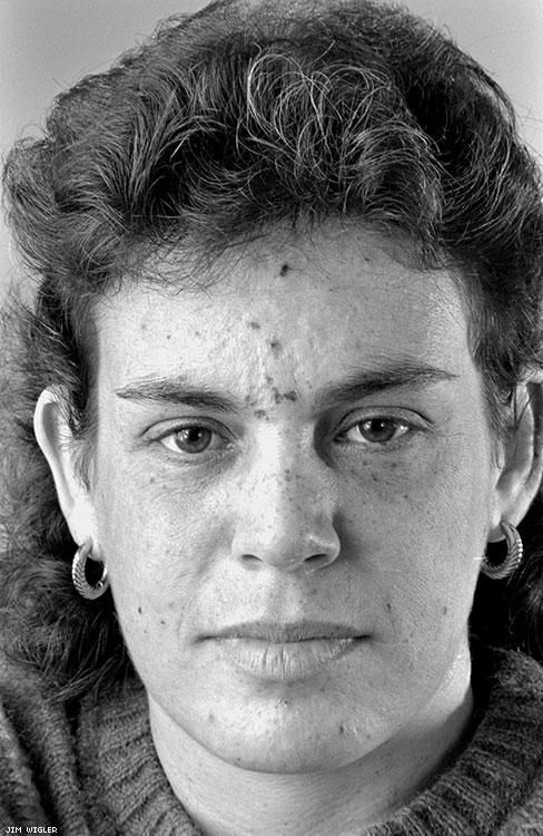 101 Faces of AIDS at the Start of an Epidemic